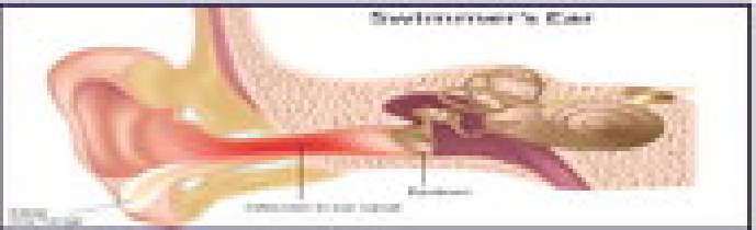 Prevent swimmer’s ear, disinfect pools - Service Industry News